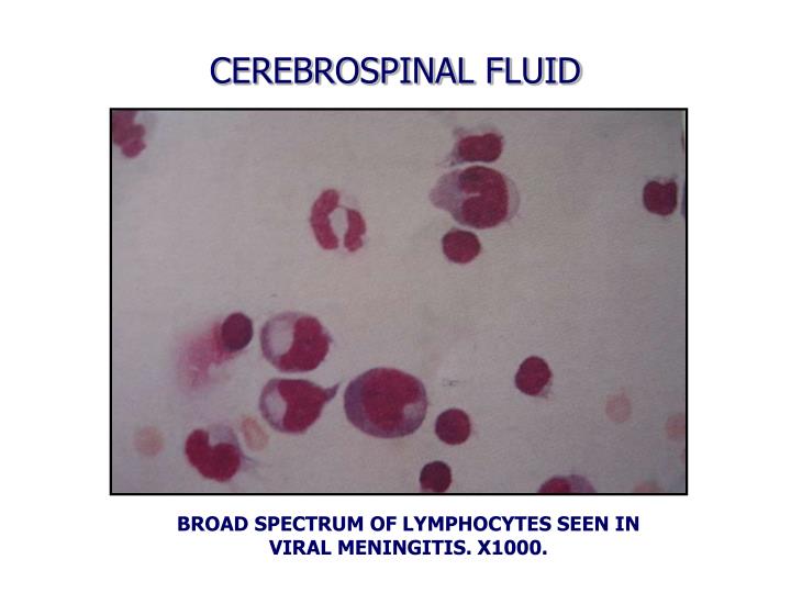 PPT - BODY FLUIDS PowerPoint Presentation - ID:166011