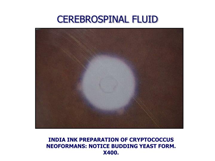 PPT - BODY FLUIDS PowerPoint Presentation - ID:166011