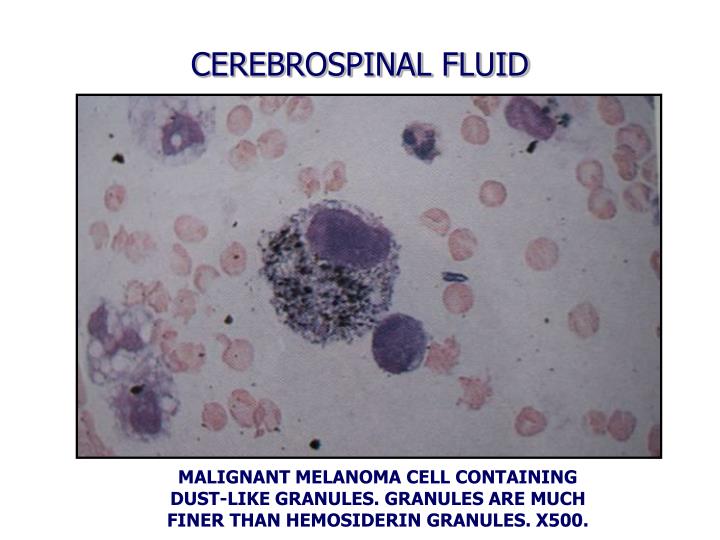 PPT - BODY FLUIDS PowerPoint Presentation - ID:166011