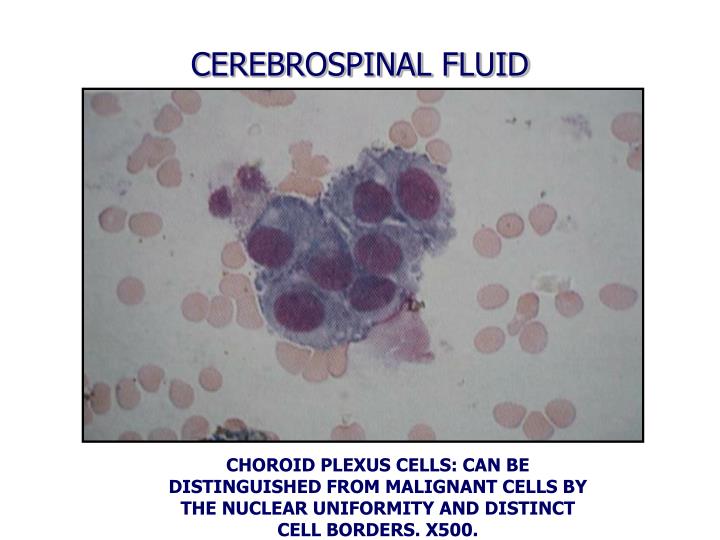 PPT - BODY FLUIDS PowerPoint Presentation - ID:166011