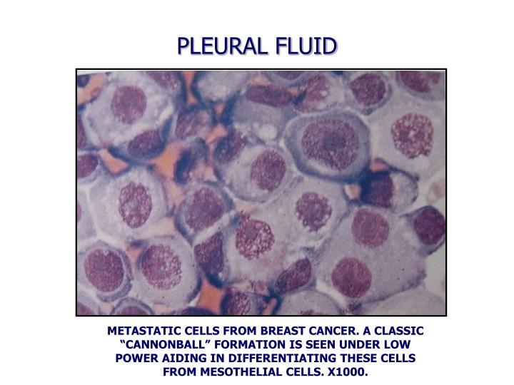 PPT - BODY FLUIDS PowerPoint Presentation - ID:166011