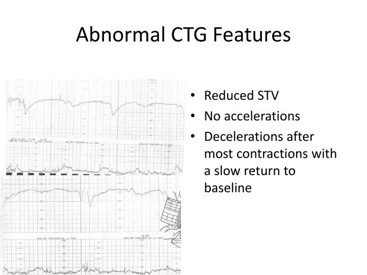 PPT - An Introduction to Cardiotocography – “CTG” PowerPoint ...
