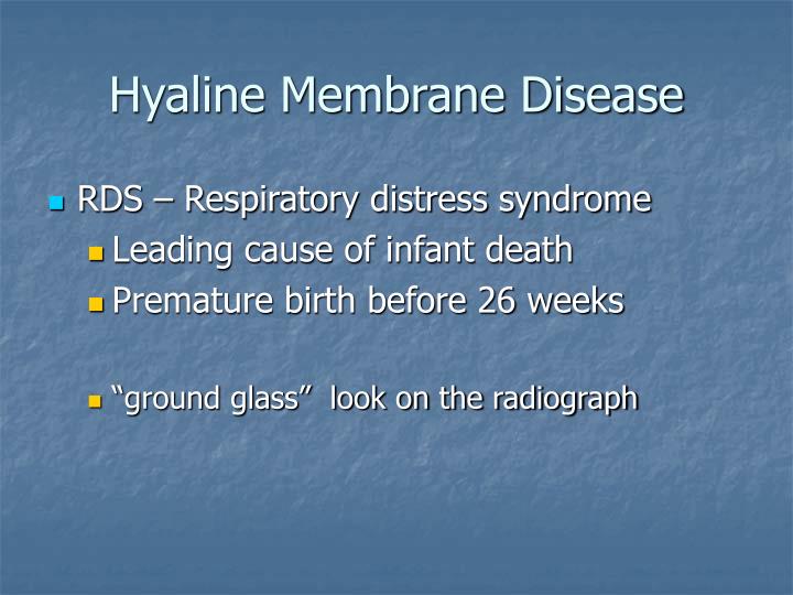 PPT - Respiratory System PowerPoint Presentation - ID:177440