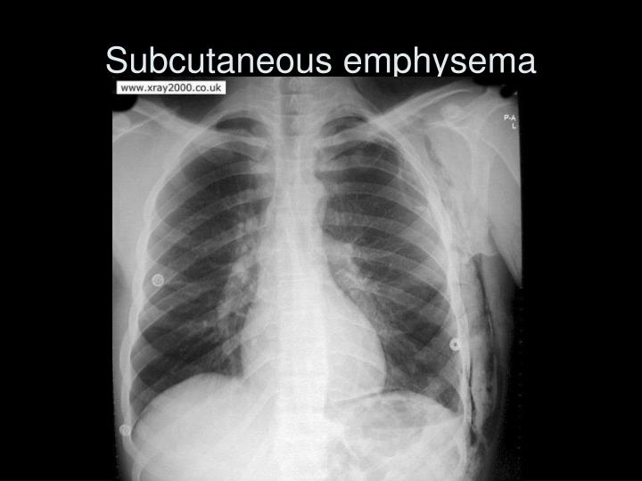 PPT - Respiratory System PowerPoint Presentation - ID:177440