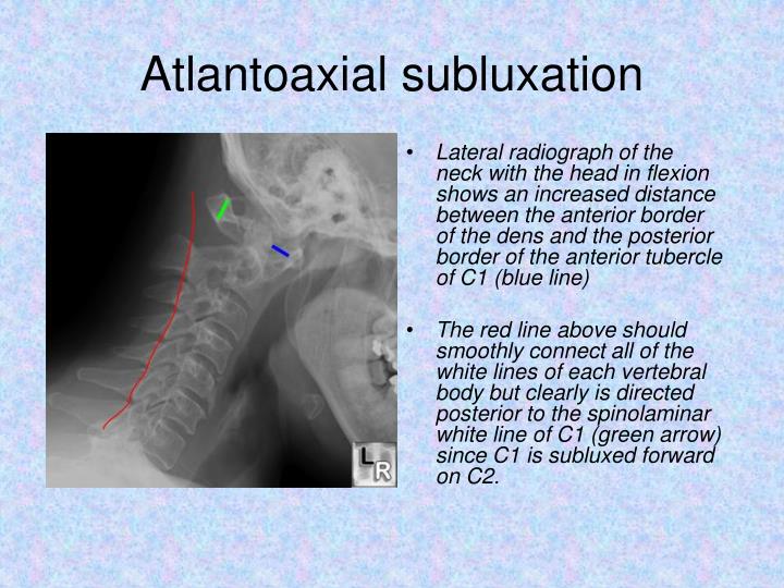 PPT - Common OSCES for Muskuloskeletal system for finals PowerPoint ...
