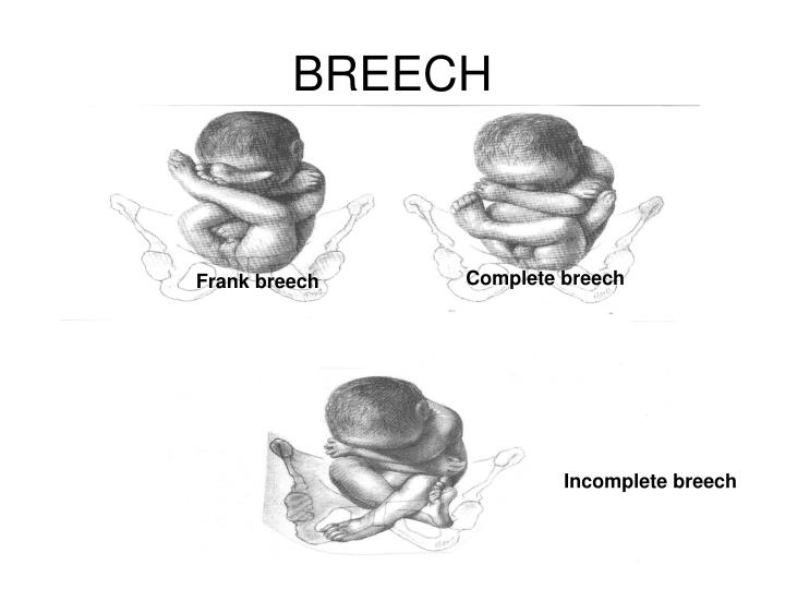 PPT Normal Labor And Delivery PowerPoint Presentation ID 192316 PPT Normal Labor And Delivery PowerPoint Presentation ID 192316