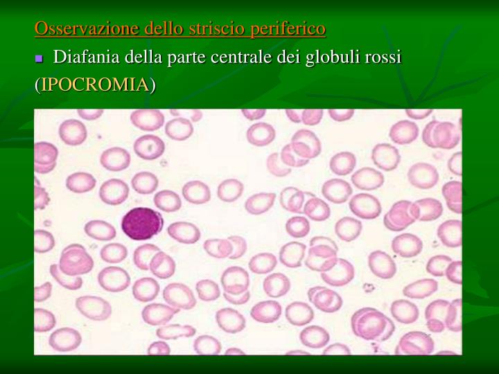 PPT - Ematopoiesi PowerPoint Presentation - ID:193770