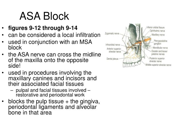 Asa Local Anesthesia at Mary Lockridge blog