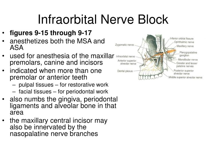 PPT - Local Anesthesia PowerPoint Presentation - ID:193943