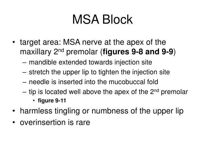 PPT - Local Anesthesia PowerPoint Presentation - ID:193943