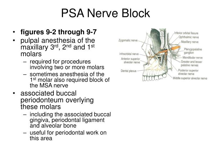PPT - Local Anesthesia PowerPoint Presentation - ID:193943