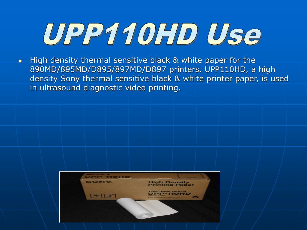PPT - Ultrasound Paper Sony Upp110hd PowerPoint Presentation, free ...