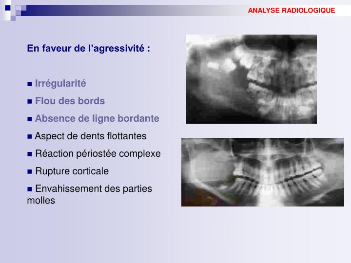 PPT - KYSTES ET TUMEURS MAXILLO-MANDIBULAIRES PowerPoint Presentation ...
