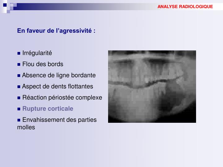 PPT - KYSTES ET TUMEURS MAXILLO-MANDIBULAIRES PowerPoint Presentation ...