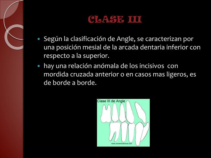 PPT - MALOCLUSIONES CLASE III PowerPoint Presentation - ID:195808