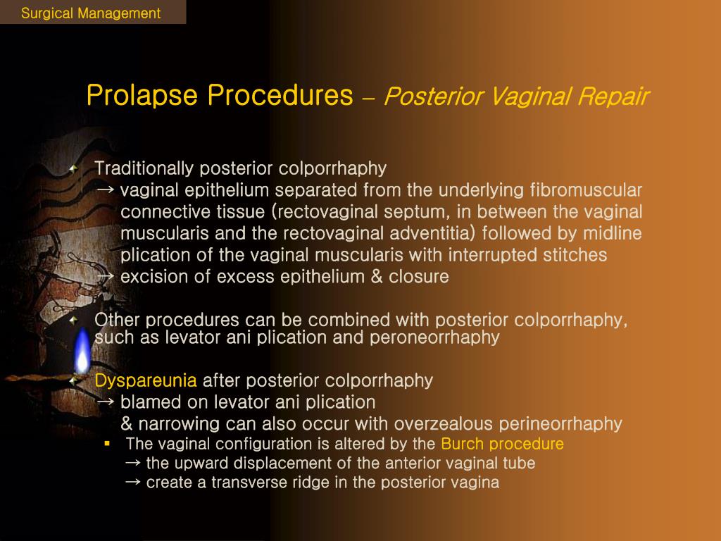Ppt Pelvic Organ Prolapse Powerpoint Presentation Free Download Id