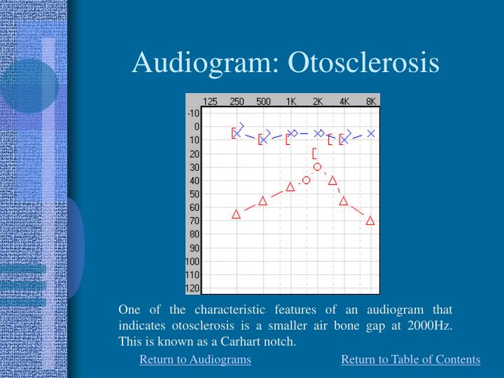 PPT - Audiology Resource Notebook PowerPoint Presentation - ID:199997