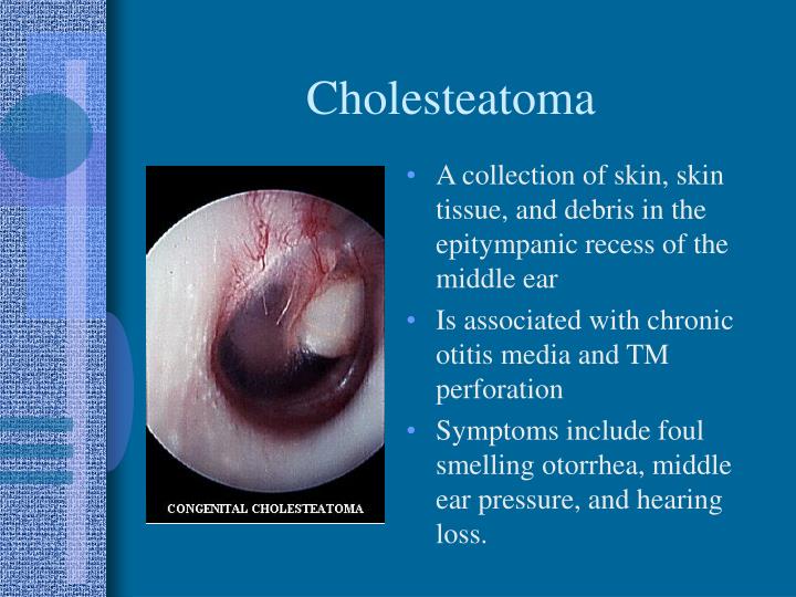 PPT - Audiology Resource Notebook PowerPoint Presentation - ID:199997