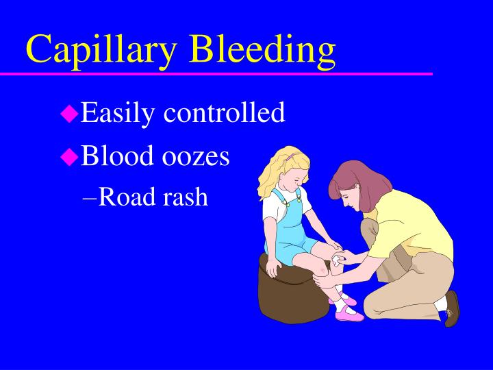 PPT - Bleeding And Wounds PowerPoint Presentation - ID:204029