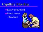 PPT - Bleeding And Wounds PowerPoint Presentation - ID:204029