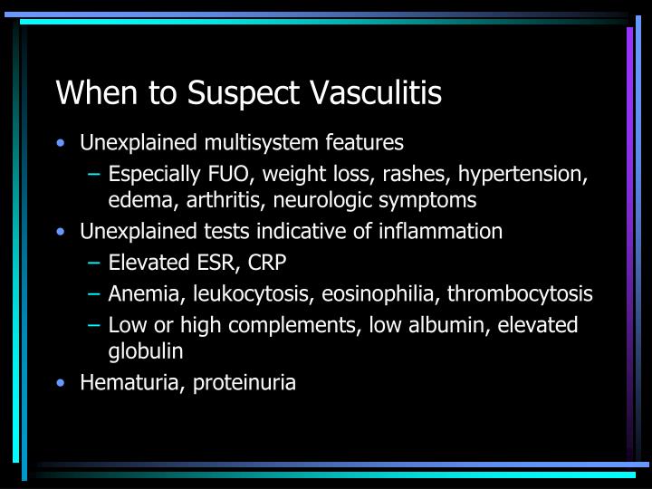 PPT - Pediatric Vasculitis PowerPoint Presentation - ID:209569