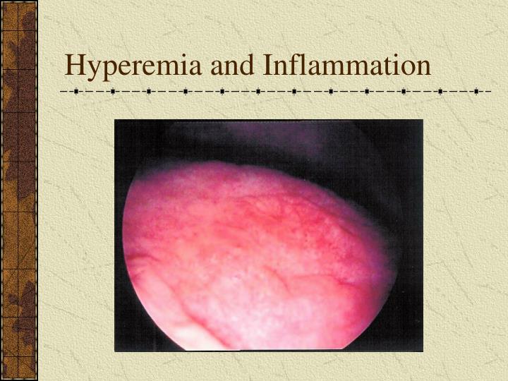 PPT - Endoscopy and Radiology for Lower Urinary Tract Dysfunction ...