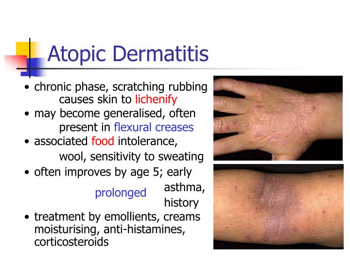 PPT - Non-Infectious Skin Diseases PowerPoint Presentation - ID:210732