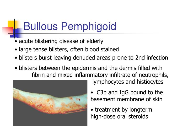 PPT - Non-Infectious Skin Diseases PowerPoint Presentation - ID:210732