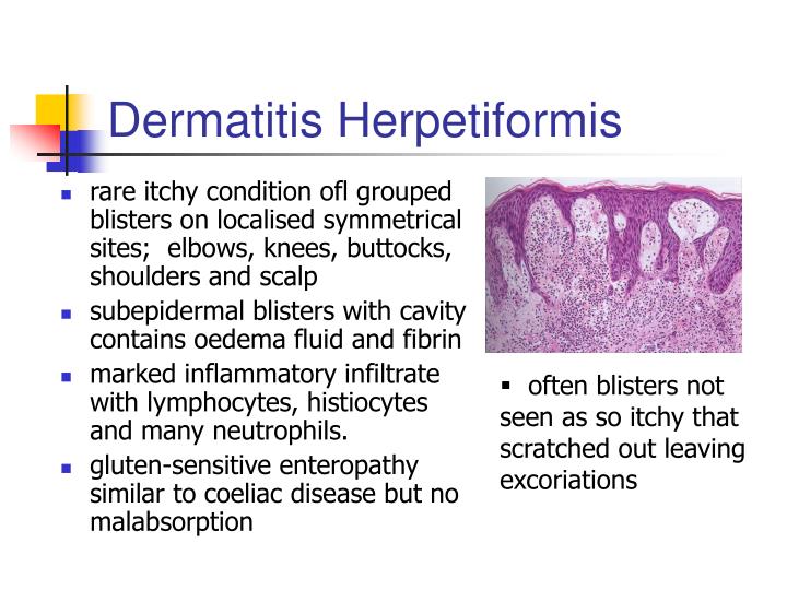PPT - Non-Infectious Skin Diseases PowerPoint Presentation - ID:210732