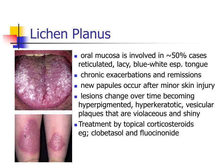 PPT - Non-Infectious Skin Diseases PowerPoint Presentation - ID:210732