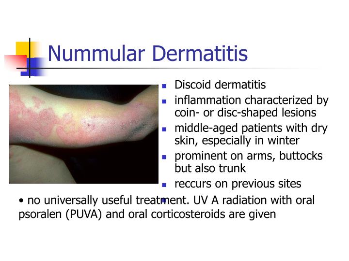 PPT - Non-Infectious Skin Diseases PowerPoint Presentation - ID:210732