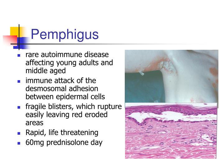 PPT - Non-Infectious Skin Diseases PowerPoint Presentation - ID:210732