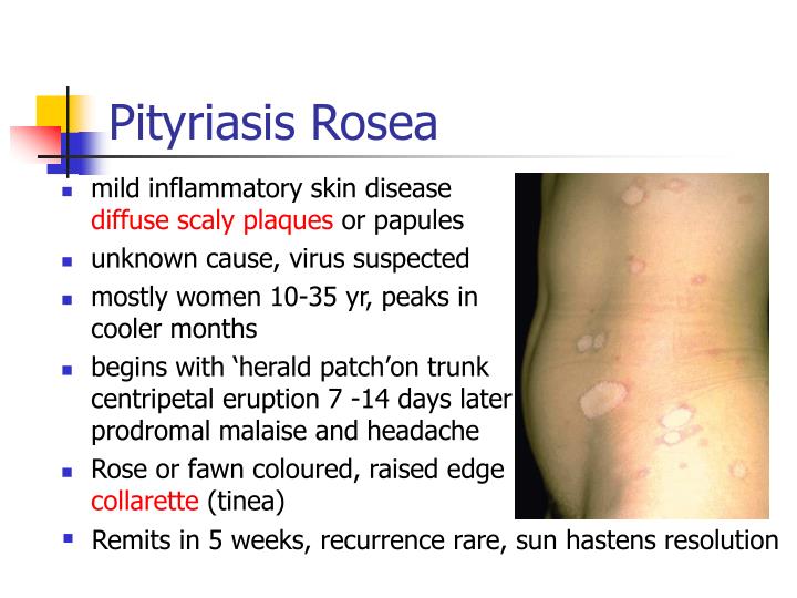 PPT - Non-Infectious Skin Diseases PowerPoint Presentation - ID:210732