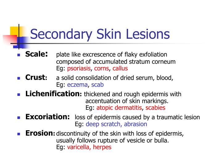 PPT - Non-Infectious Skin Diseases PowerPoint Presentation - ID:210732