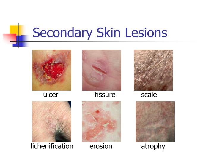 PPT - Non-Infectious Skin Diseases PowerPoint Presentation - ID:210732