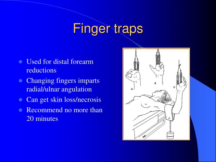 PPT - Orthopaedic Traction PowerPoint Presentation - ID:210938