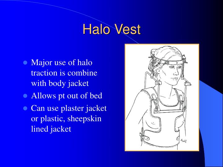 PPT - Orthopaedic Traction PowerPoint Presentation - ID:210938