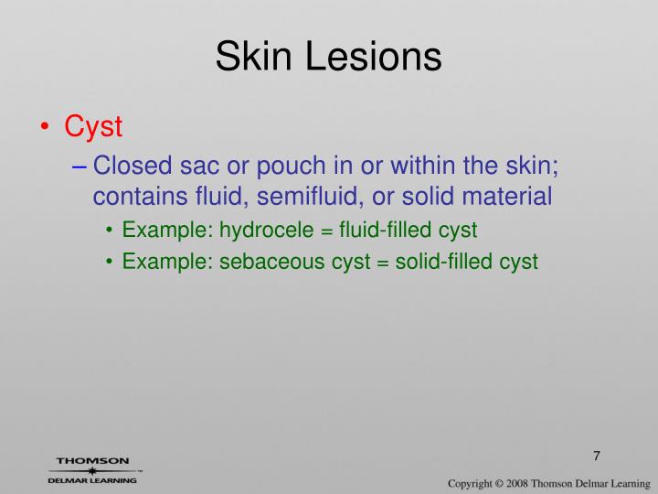 PPT - Integumentary System PowerPoint Presentation - ID:211107