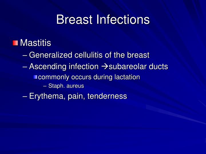 PPT - Benign Breast Disease PowerPoint Presentation - ID:214863