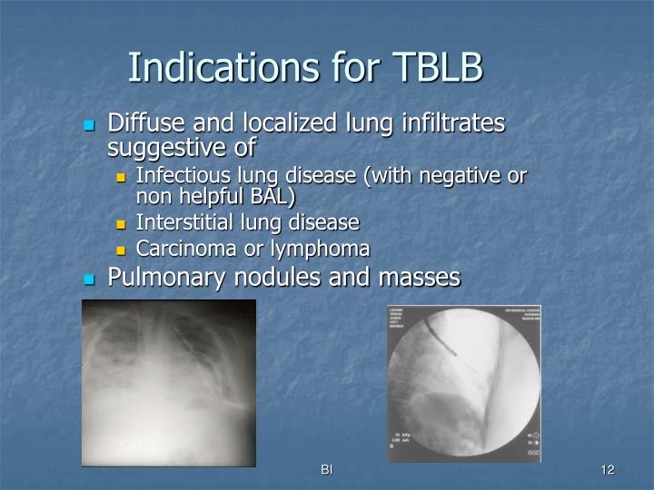 PPT - Flexible Bronchoscopy Part 4A: Transbronchial lung biopsy VOLUME ...