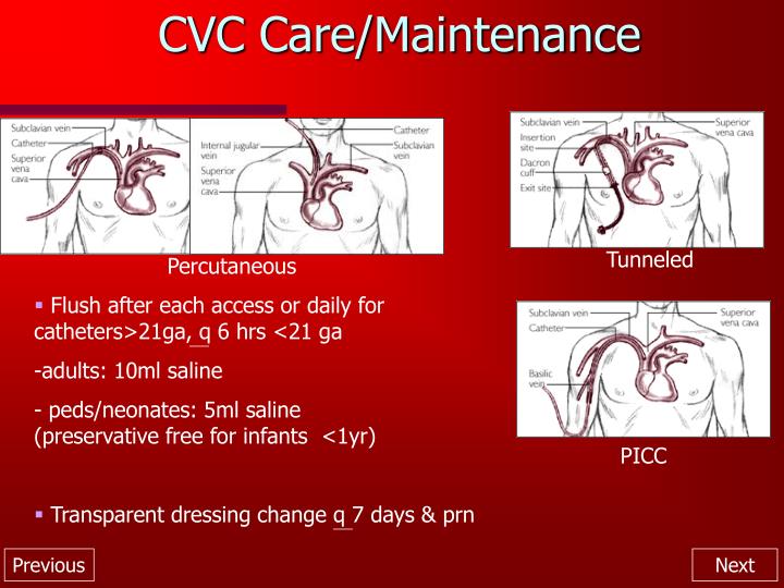 PPT - Basic Intravenous Therapy PowerPoint Presentation - ID:219119
