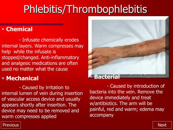 PPT - Basic Intravenous Therapy PowerPoint Presentation - ID:219119