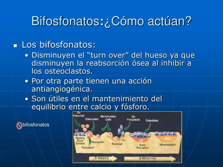 PPT - Osteonecrosis de la mandíbula y bifosfonatos: semiología en TC ...