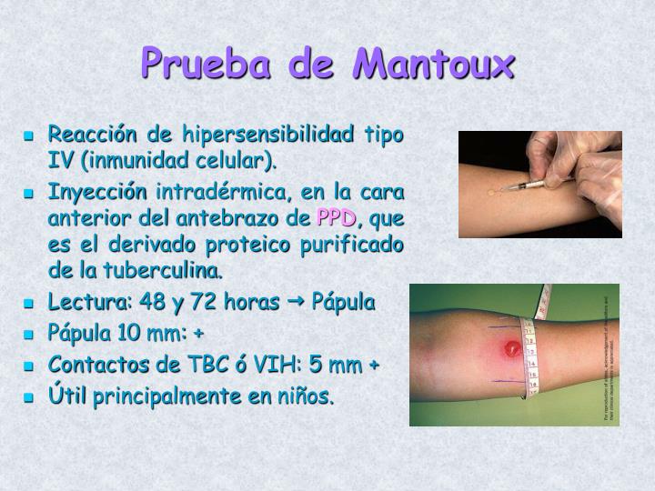 PPT - TBC EN ORL PowerPoint Presentation - ID:221872