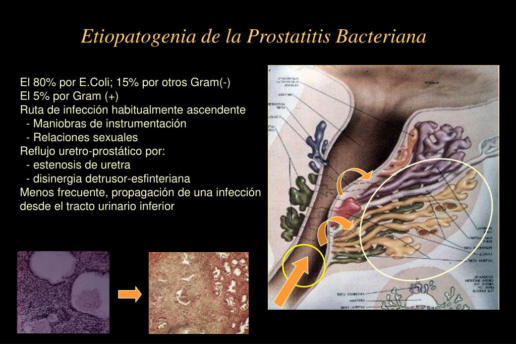 PPT - INFECCION URINARIA PowerPoint Presentation, free download - ID:223979