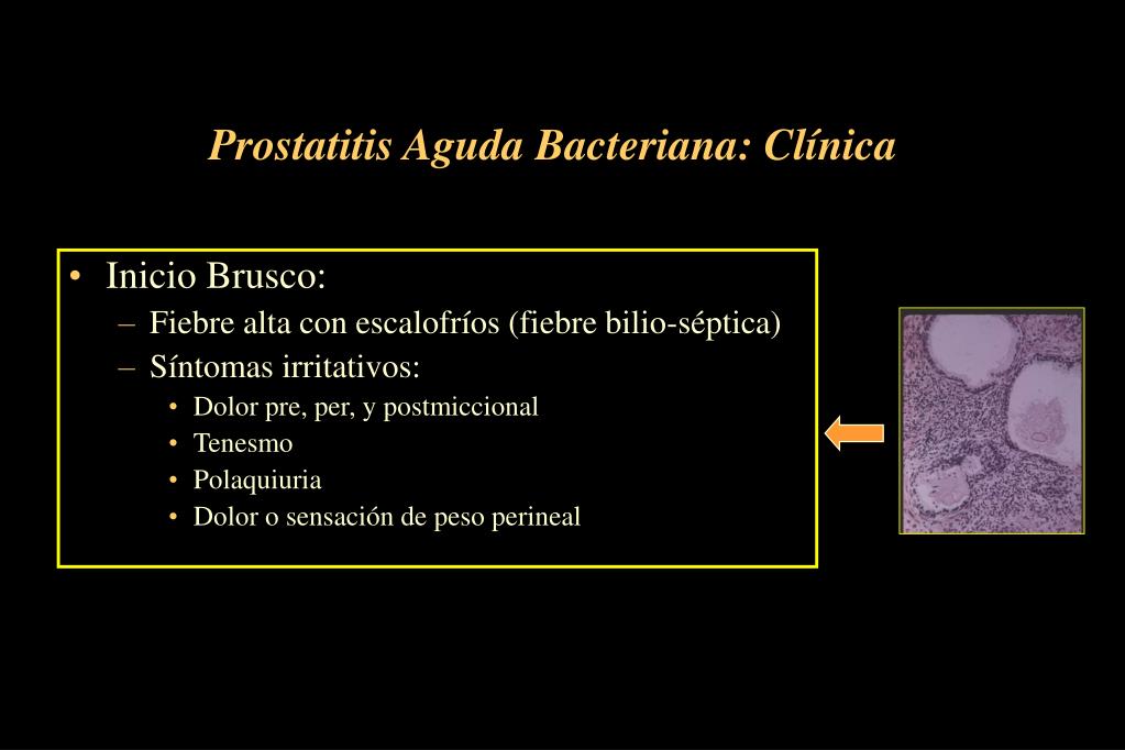 PPT - INFECCION URINARIA PowerPoint Presentation, free download - ID:223979