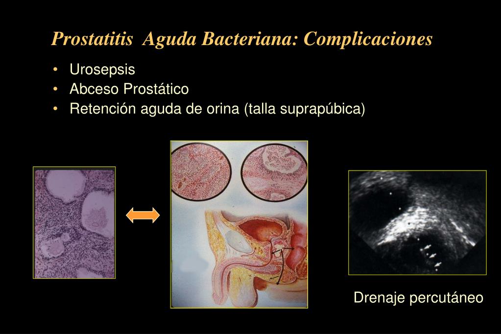 PPT - INFECCION URINARIA PowerPoint Presentation, free download - ID:223979