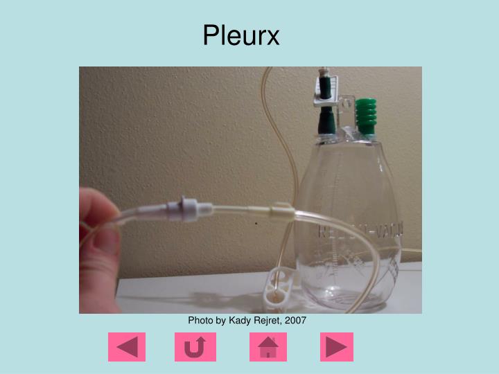 PPT - Pleural Effusions PowerPoint Presentation - ID:224571