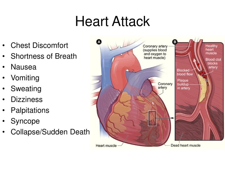 PPT - Cardiac Physiology PowerPoint Presentation - ID:226486
