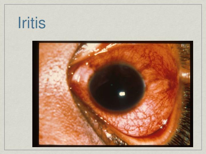 PPT - Essentials of Ophthalmology PowerPoint Presentation - ID:22855